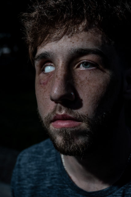 The Shot-in-the-Eye Squad | Rainforest Journalism Fund